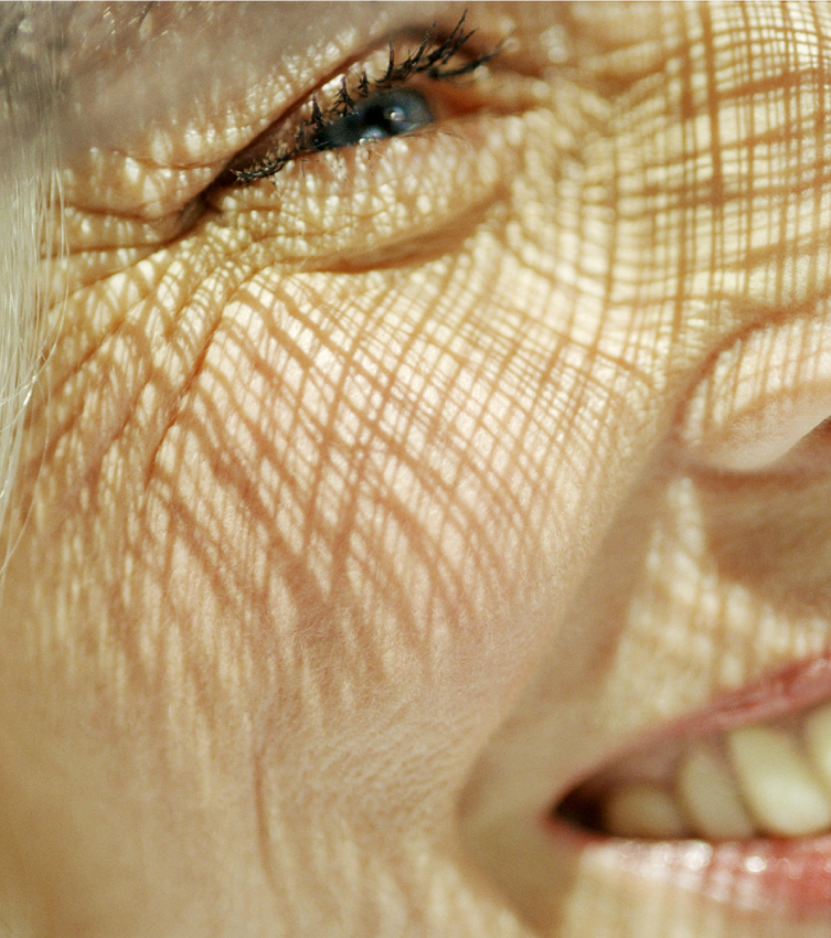 Le soleil et le vieillissement de la peau